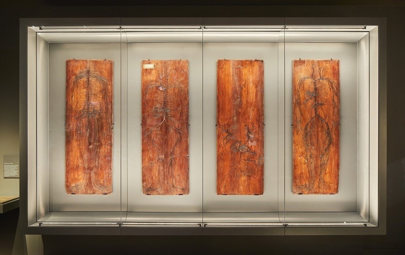 Hunterian Museum | Surgery and Anatomy – From Ancient Times to the…